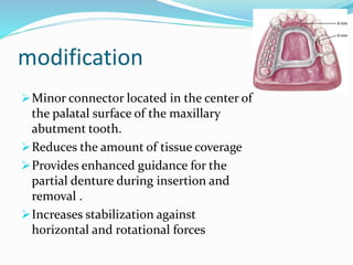 Minor connectors and rests | PPTX