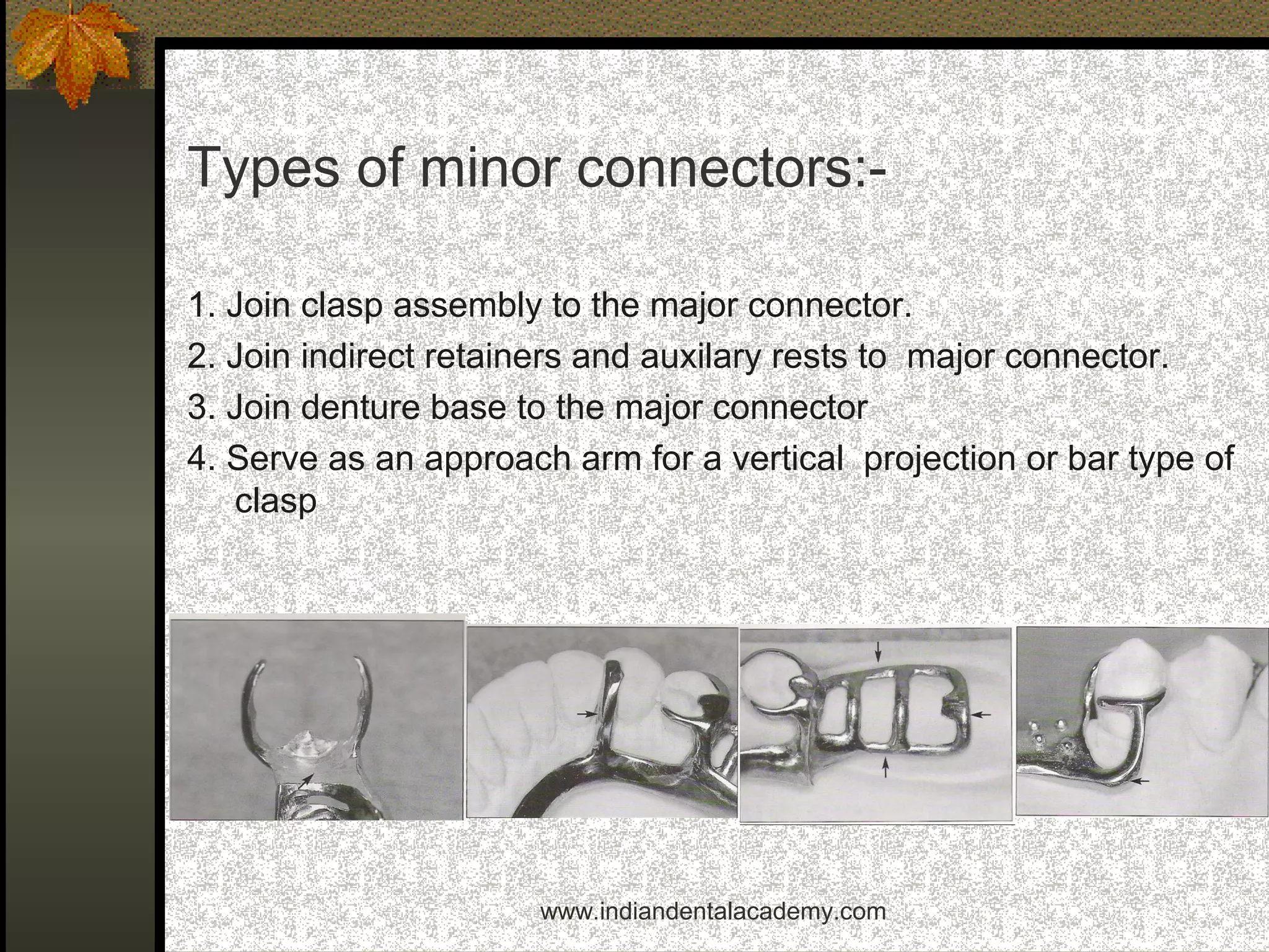 Minor connectors/ dental courses | PPT