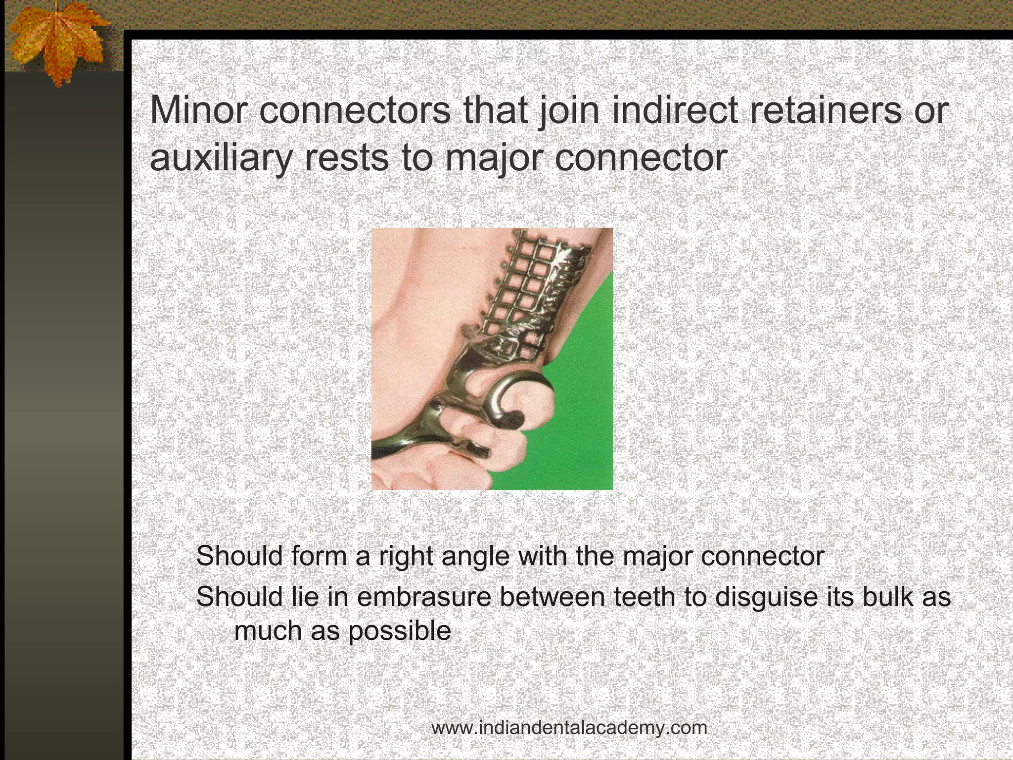 Minor connectors/ dental courses | PPT