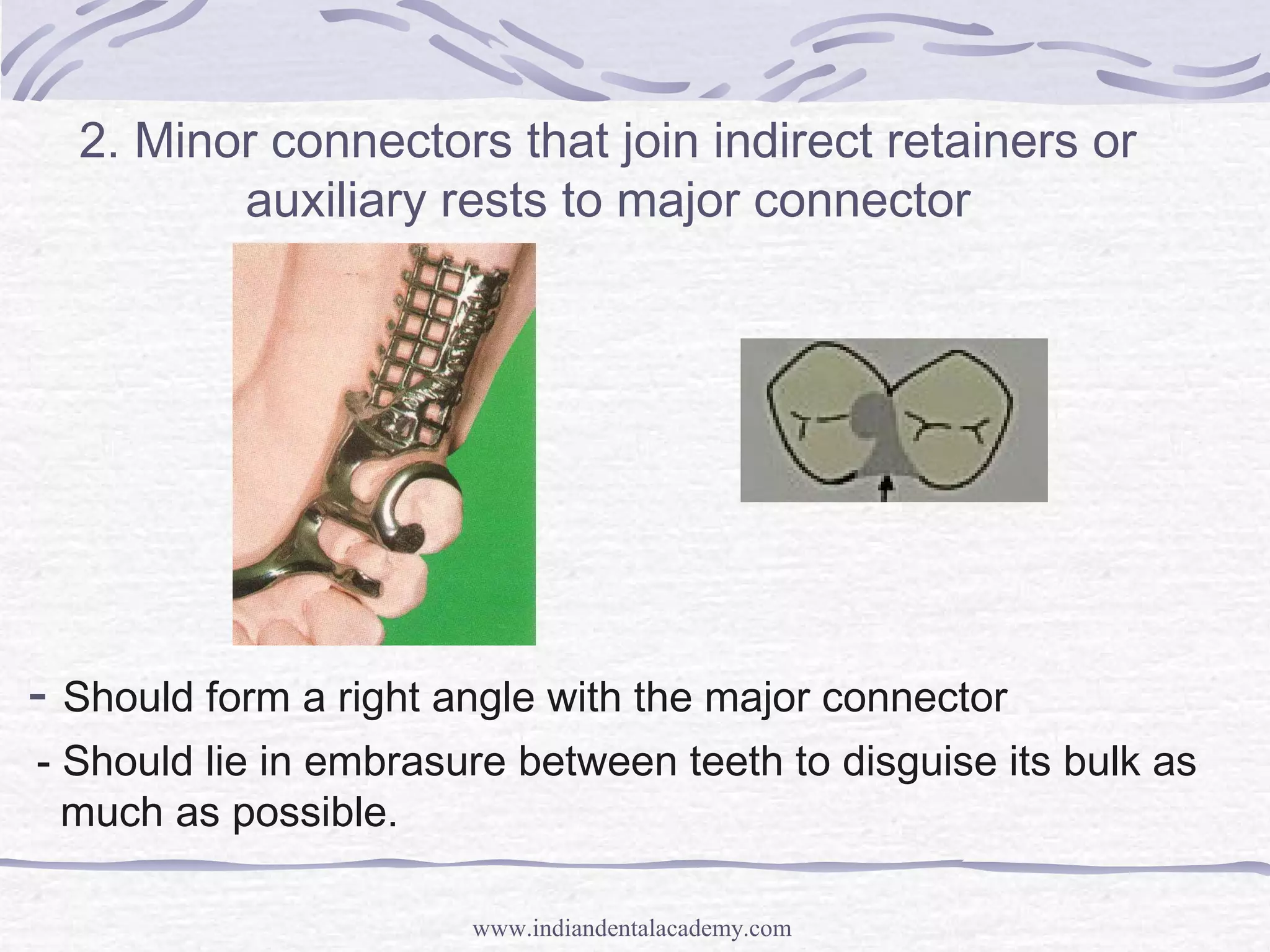 Minor connectors/ dental crown & bridge courses | PPT