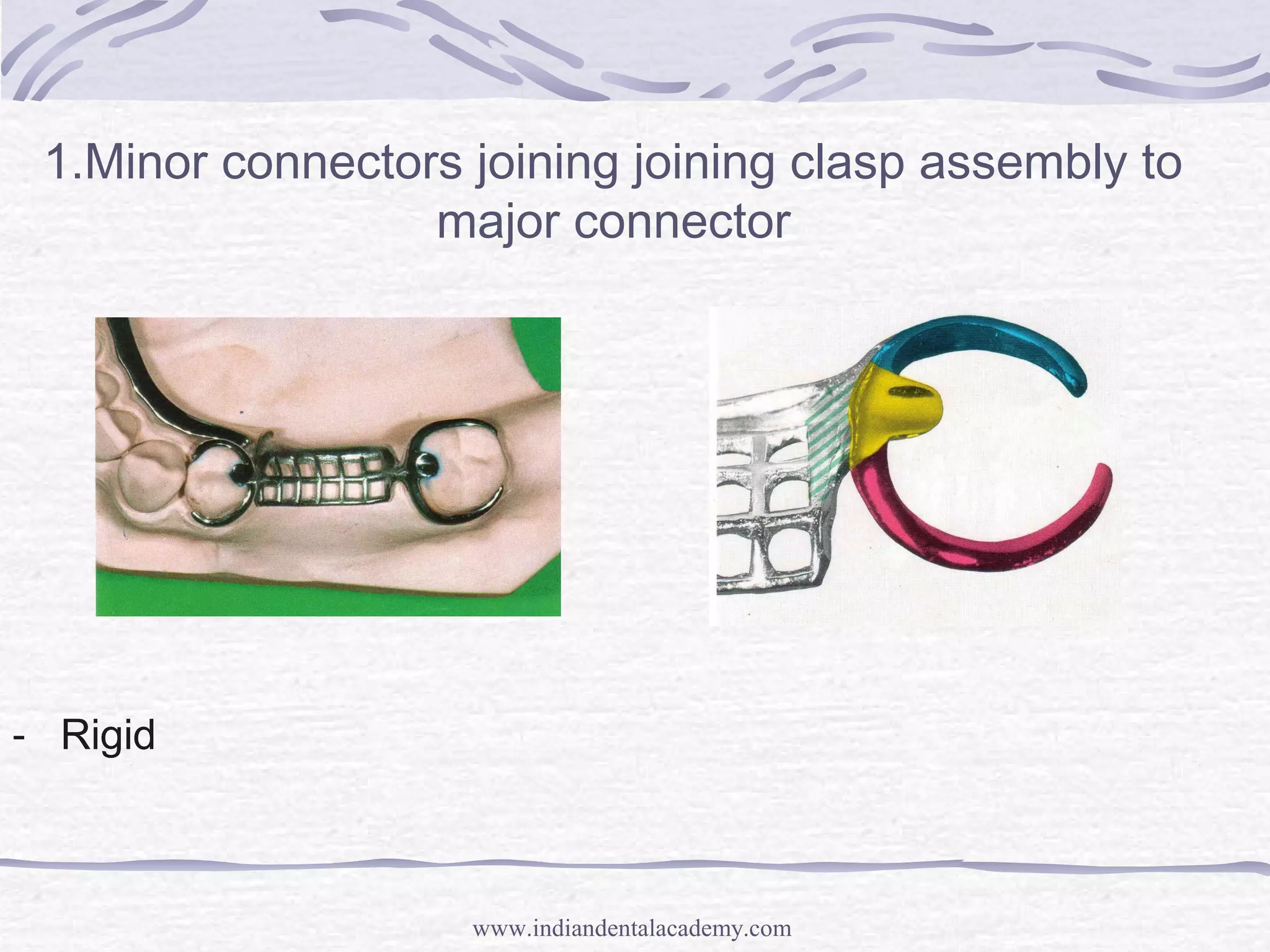 Minor connectors/ dental crown & bridge courses | PPT