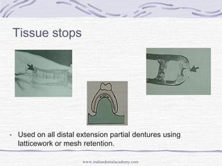 Minor connectors/ dental crown & bridge courses | PPT