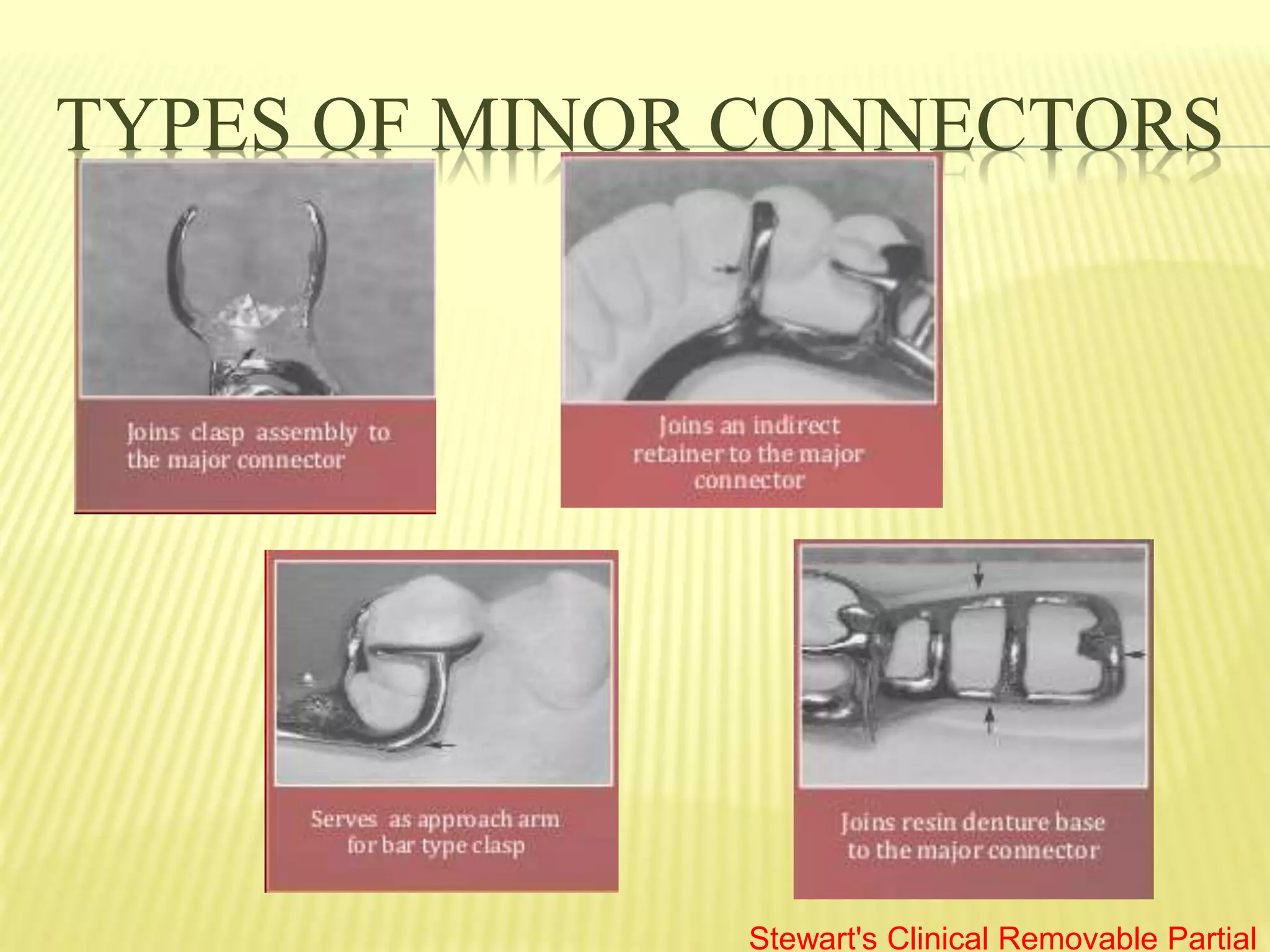 Minor connectors | PPTX