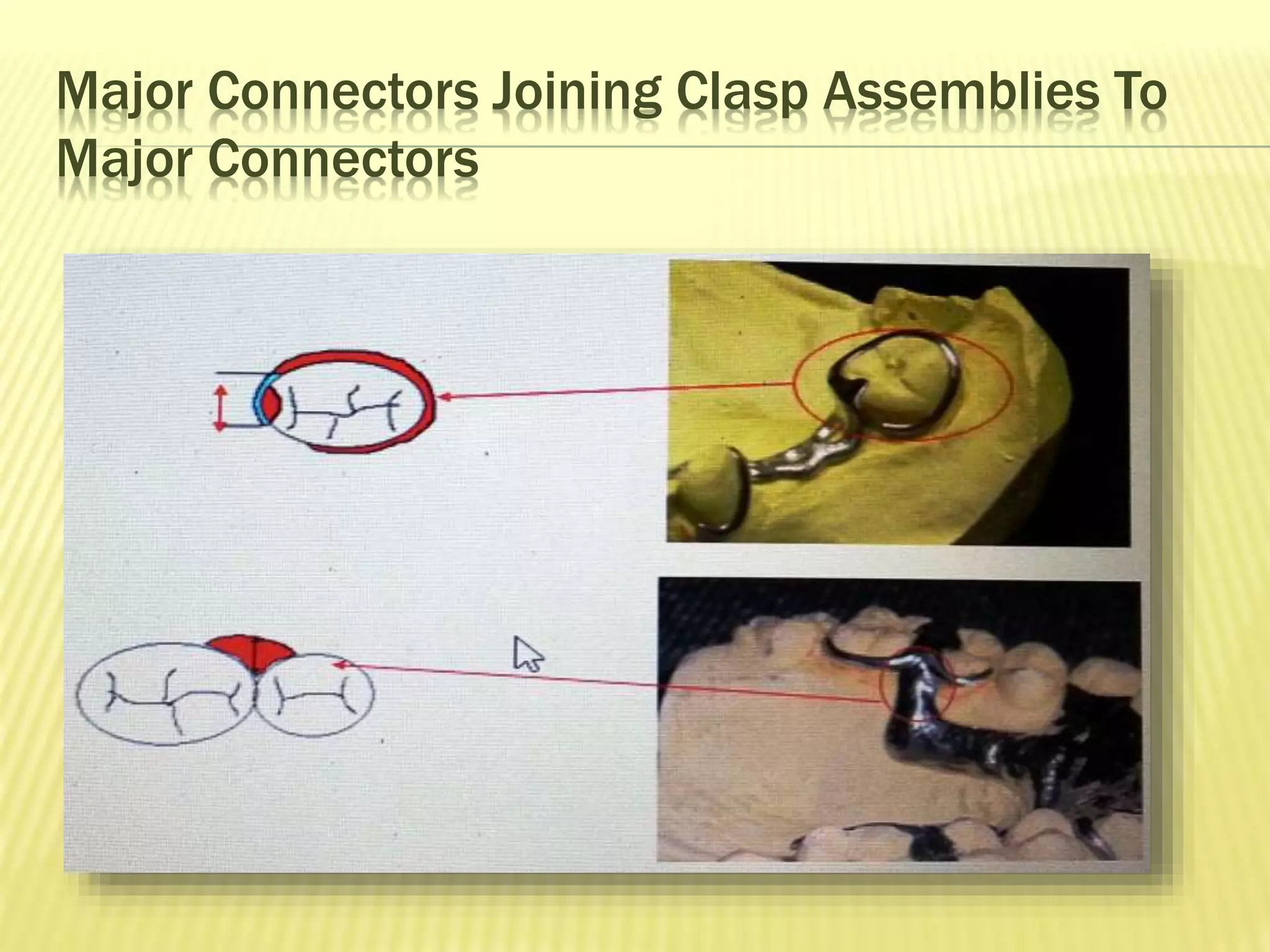 Minor connectors | PPTX