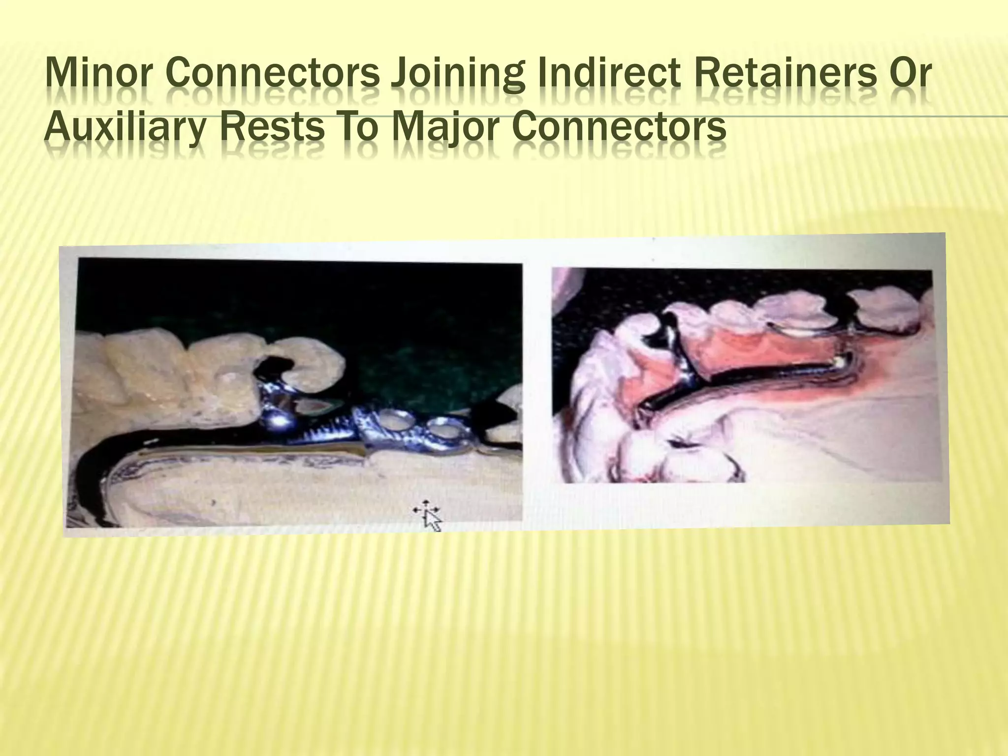 Minor connectors | PPTX