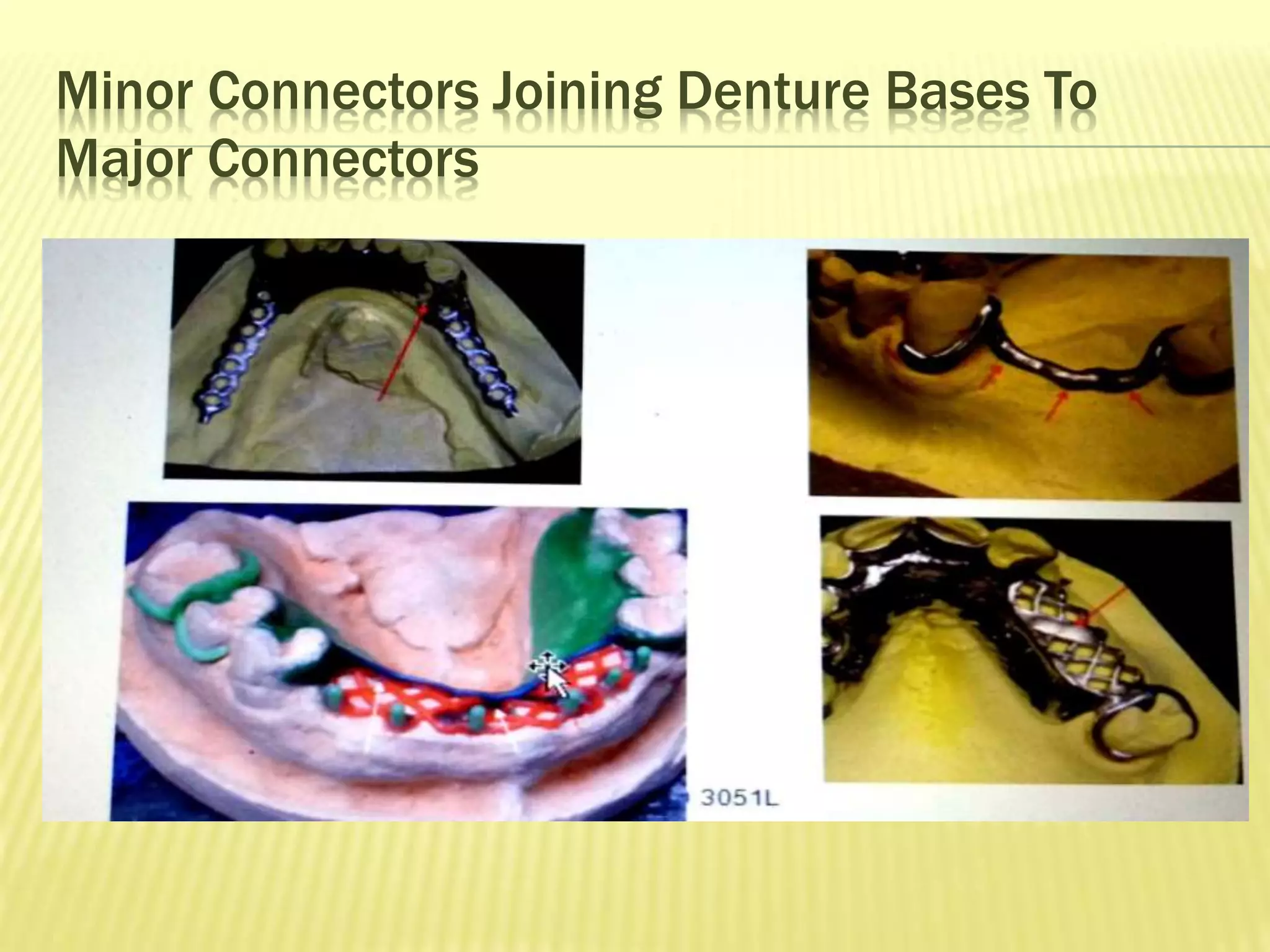 Minor connectors | PPTX
