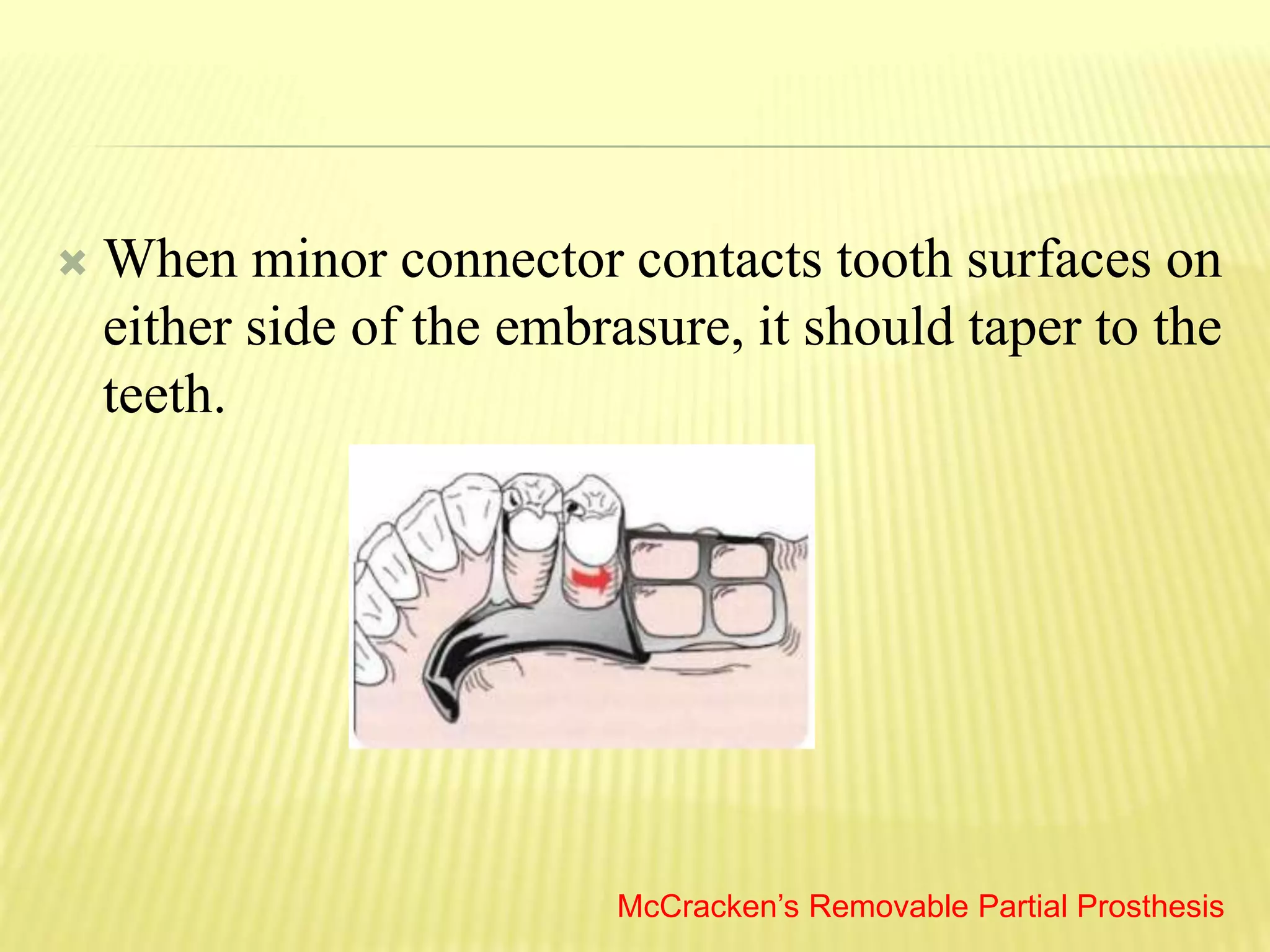 Minor connectors | PPTX