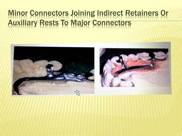 Minor connectors | PPTX