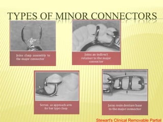 Minor connectors | PPT