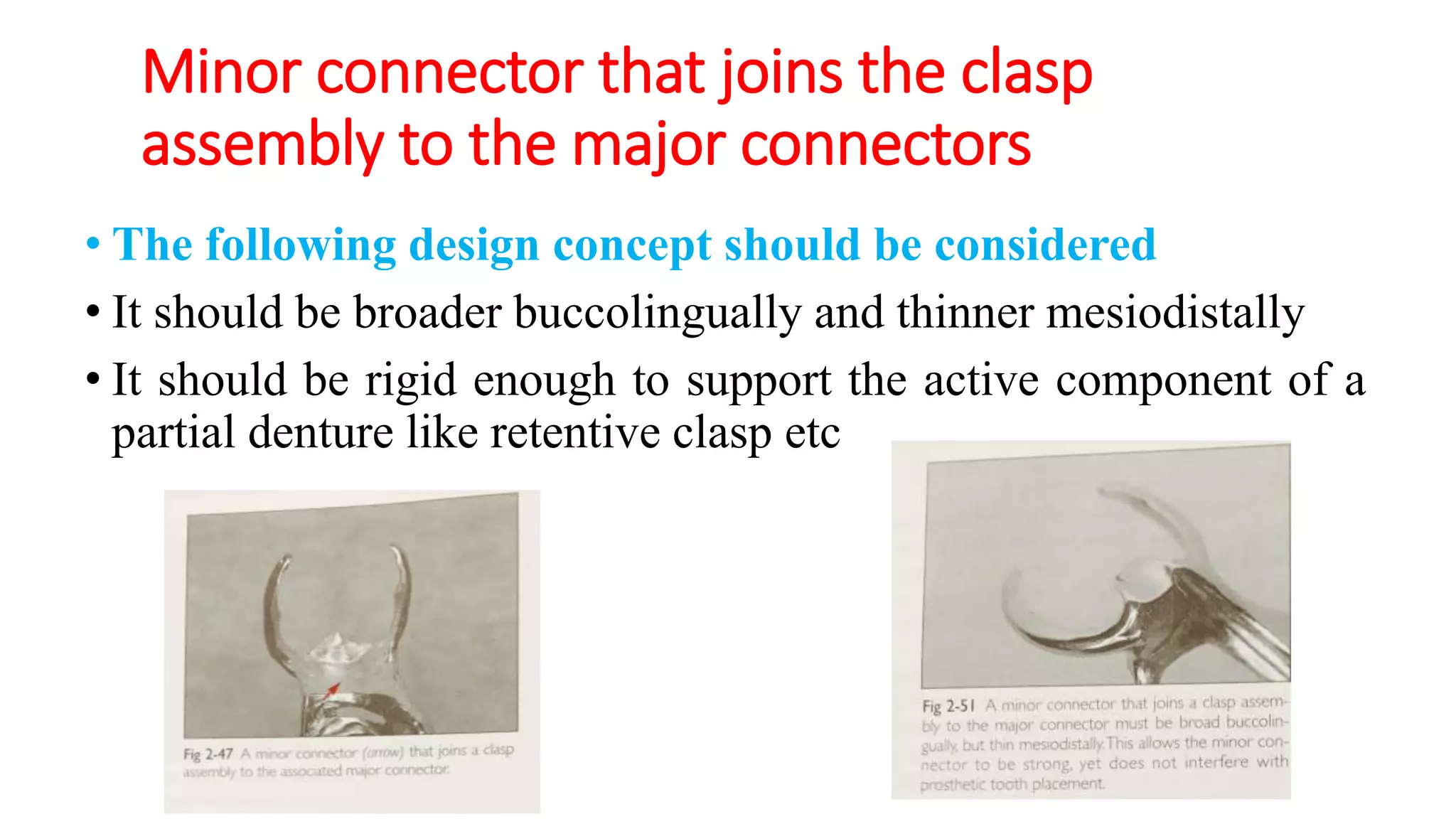 Minor connectors | PPTX