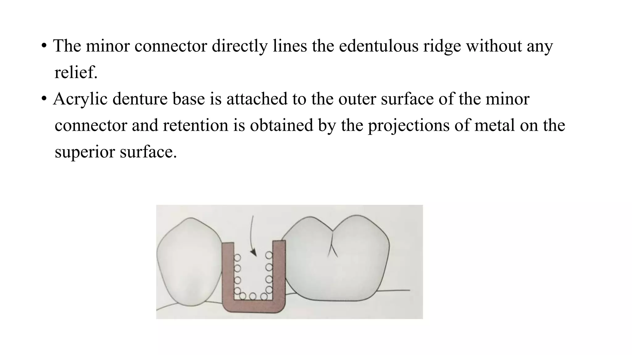 Minor connectors | PPT