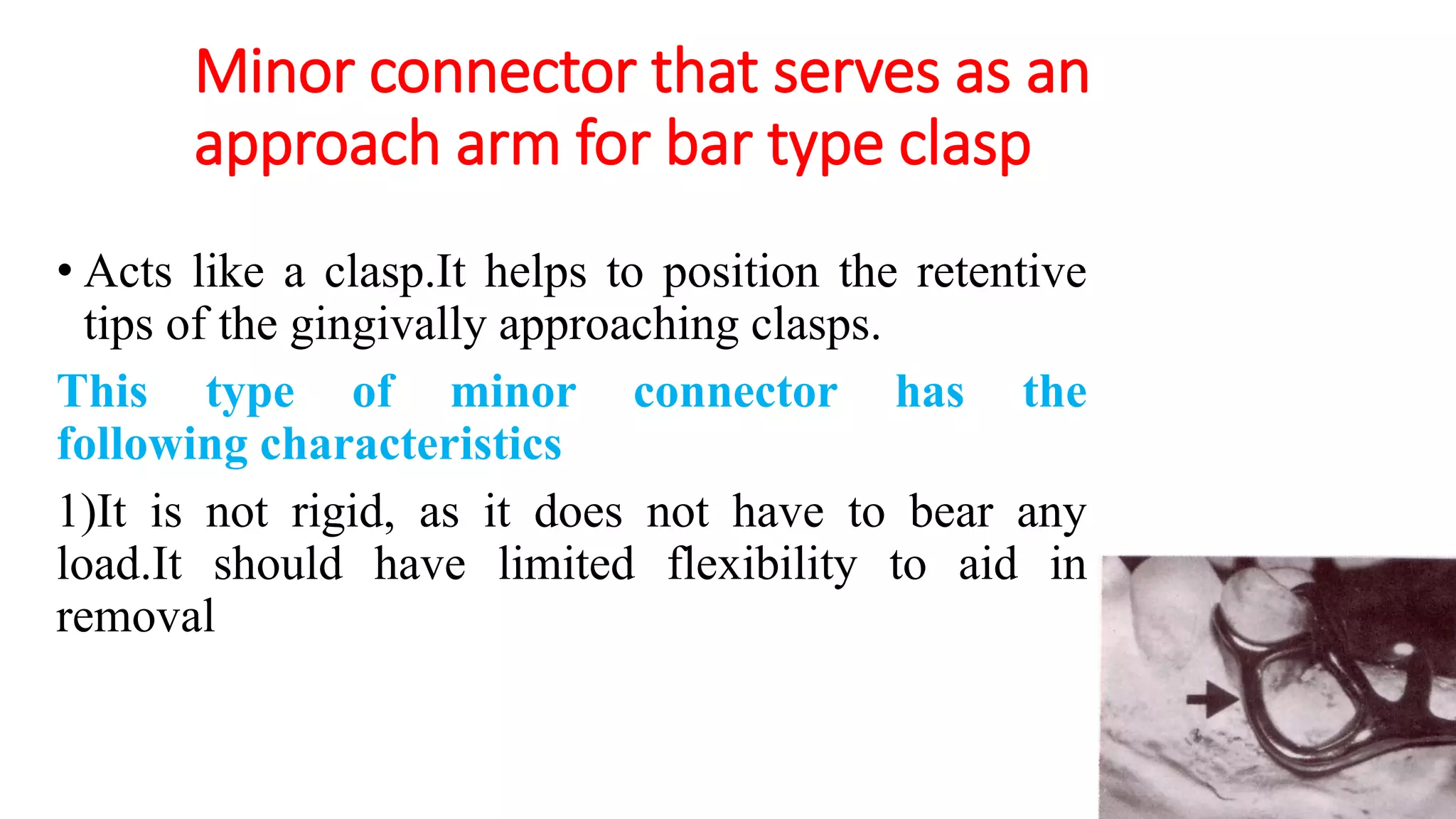 Minor connectors | PPTX