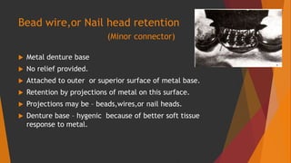 Minor connectors | PPT