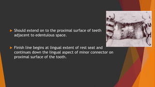 Minor connectors | PPT