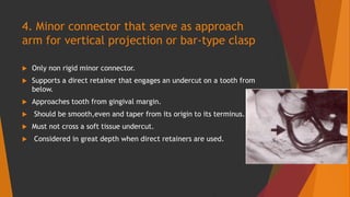 Minor connectors | PPT