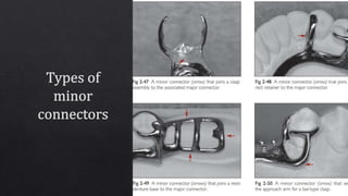 Minor connectors | PPTX
