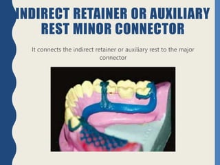 Minor Connectors.pptx
