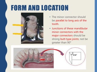 Minor Connectors.pptx