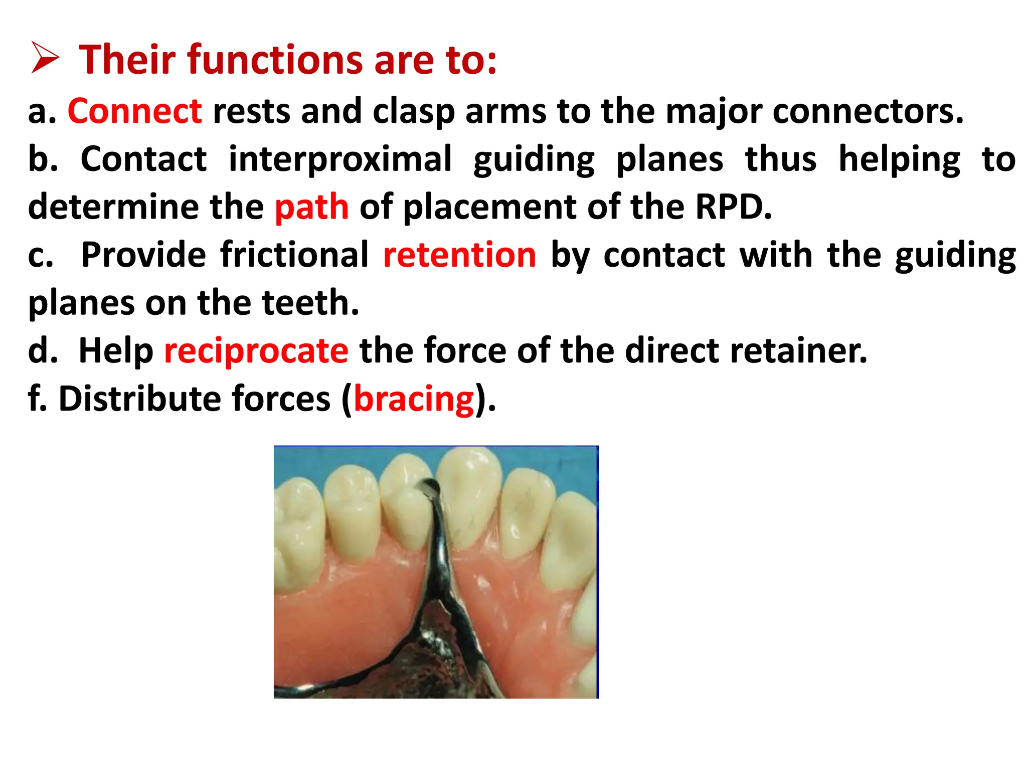 Minor connectors. Preclinical Removable Partial Denture.ppt