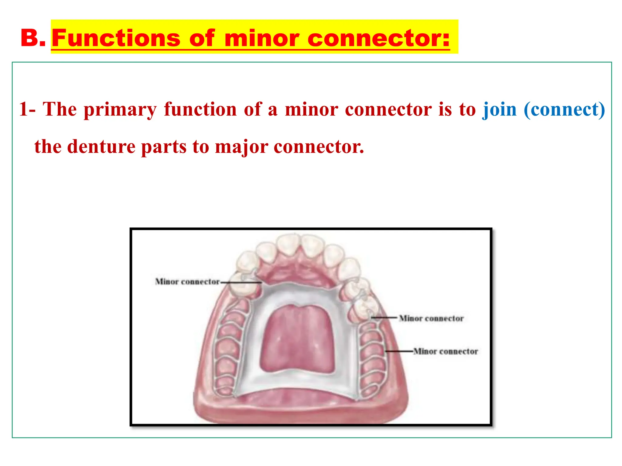 Minor connectors. Preclinical Removable Partial Denture.ppt