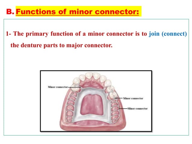 Minor connectors. Preclinical Removable Partial Denture.ppt | Dental ...