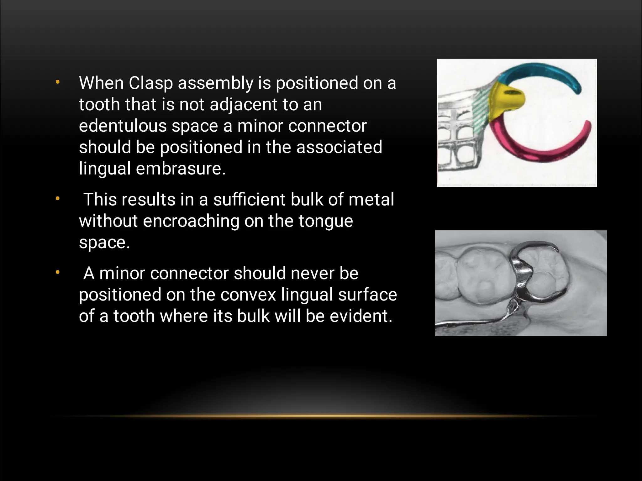 Minor connectors & rests in removable partial denture | PDF
