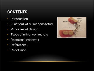 Minor connectors & rests in removable partial denture | PDF