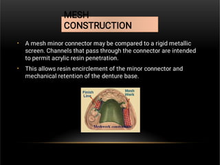 Minor connectors & rests in removable partial denture | PDF