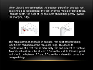 Minor connectors & rests in removable partial denture | PDF