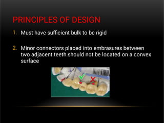 Minor connectors & rests in removable partial denture | PDF