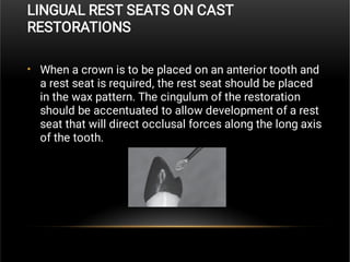 Minor connectors & rests in removable partial denture | PDF