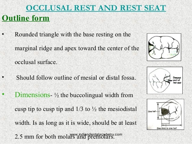 Minor connectors & rests & rest seats /certified fixed orthodontic co…