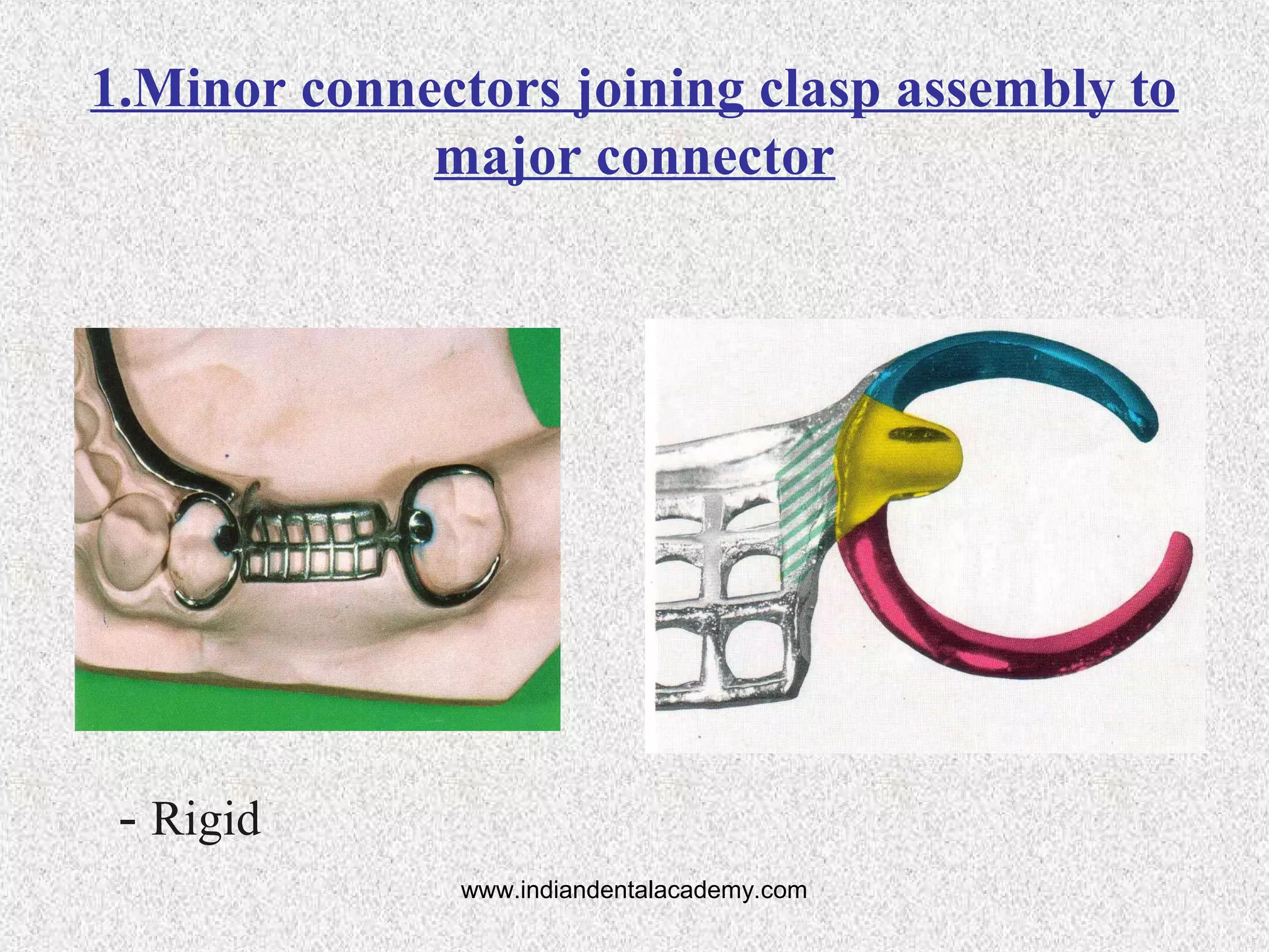 Minor connectors & rests & rest seats/ dental implant courses | PPT