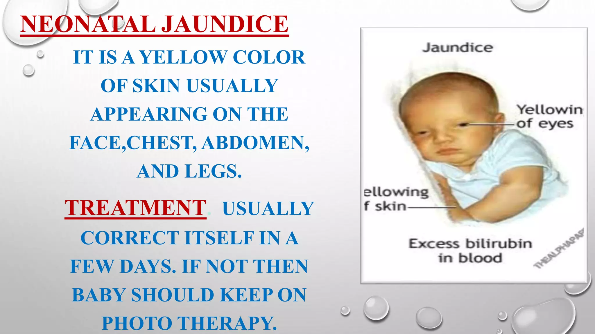 Minor Disorders Of Newborn Ppt