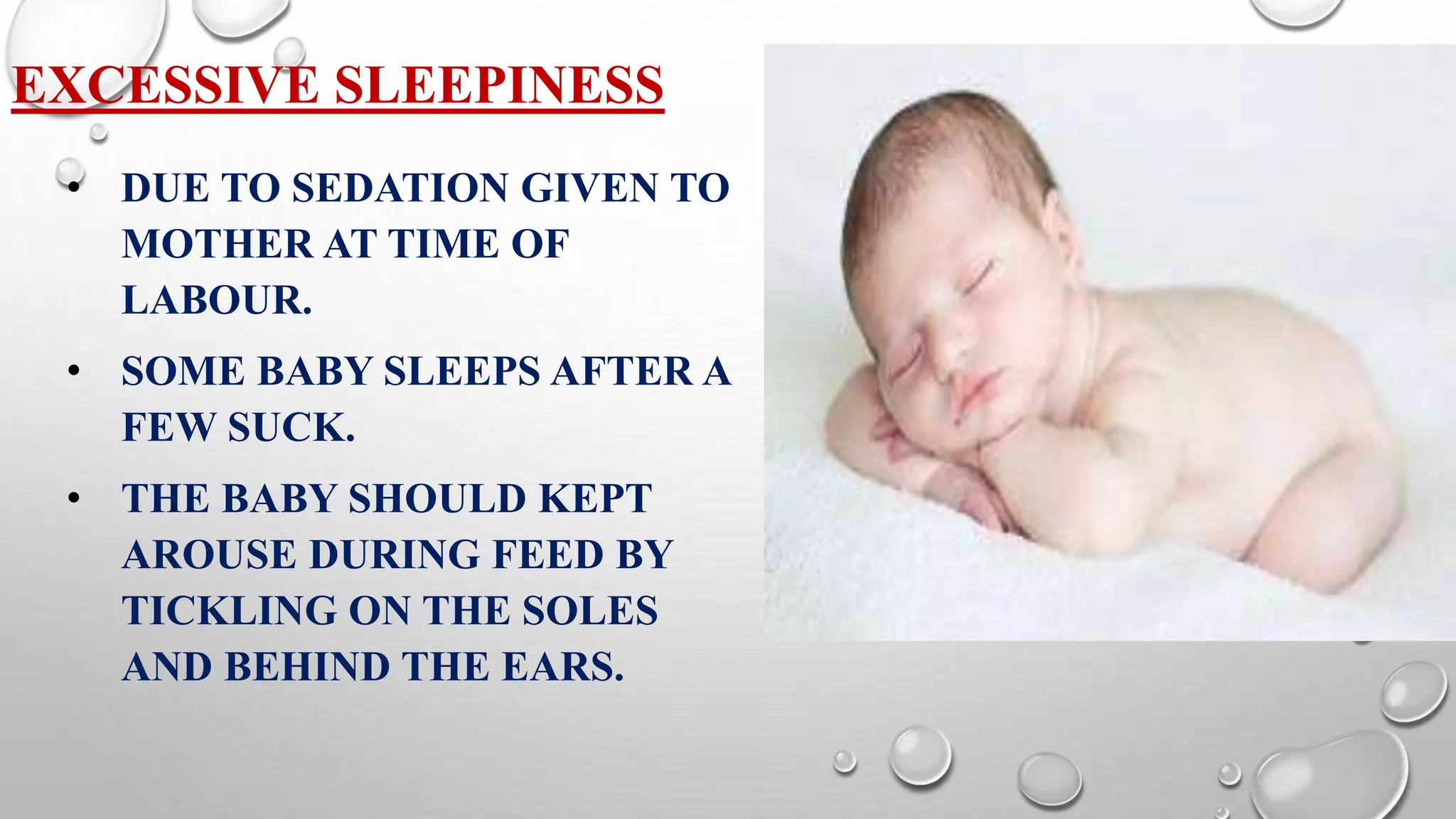 Minor disorders of newborn | PPTX