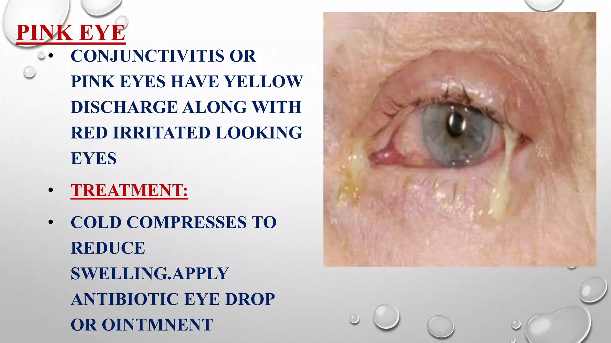 Minor disorders of newborn | PPTX