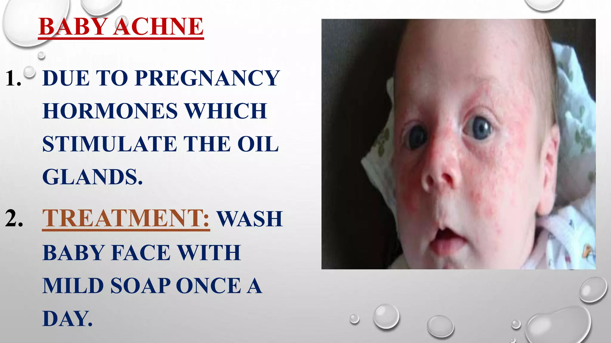 Minor disorders of newborn | PPTX