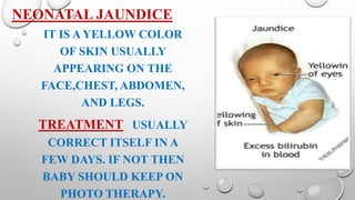 Minor disorders of newborn | PPTX