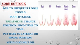 Minor disorders of newborn | PPTX