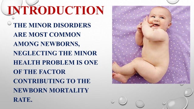 Minor Disorders Of Newborn Ppt