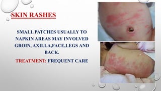 Minor disorders of newborn | PPTX