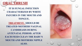 Minor disorders of newborn | PPTX