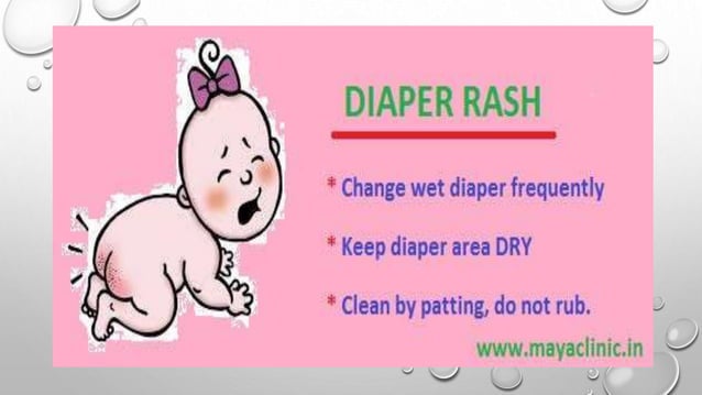 Minor Disorders Of Newborn Ppt