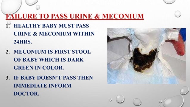 Minor Disorders Of Newborn Ppt