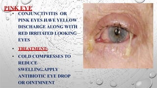 minor disorders of bnewborn.pptx