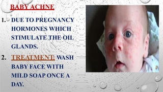 minor disorders of bnewborn.pptx