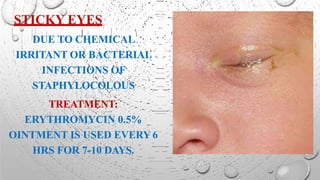 minor disorders of bnewborn.pptx
