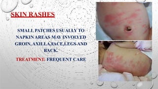 minor disorders of bnewborn.pptx