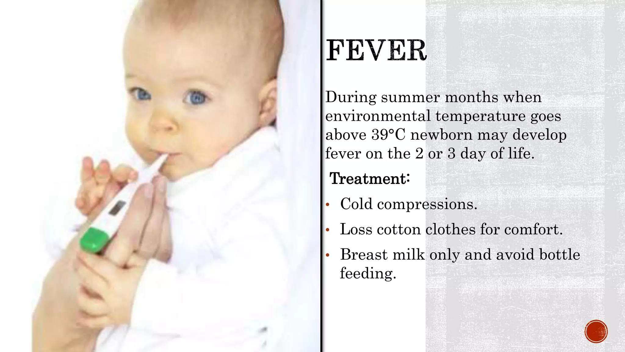 Minor Disorders Of Newborn 1 Ppt