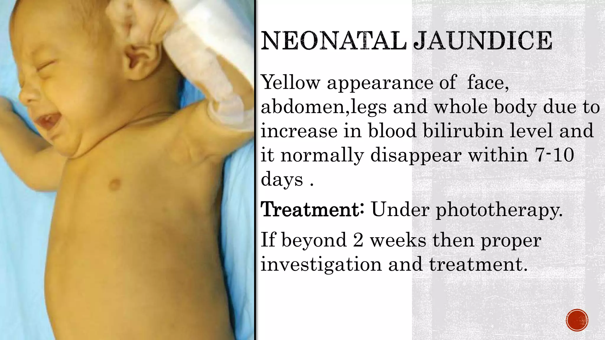 Minor disorders of newborn 1 | PPTX